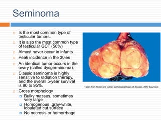 Testicular pathology, sufia husain, 2018 | PPTX