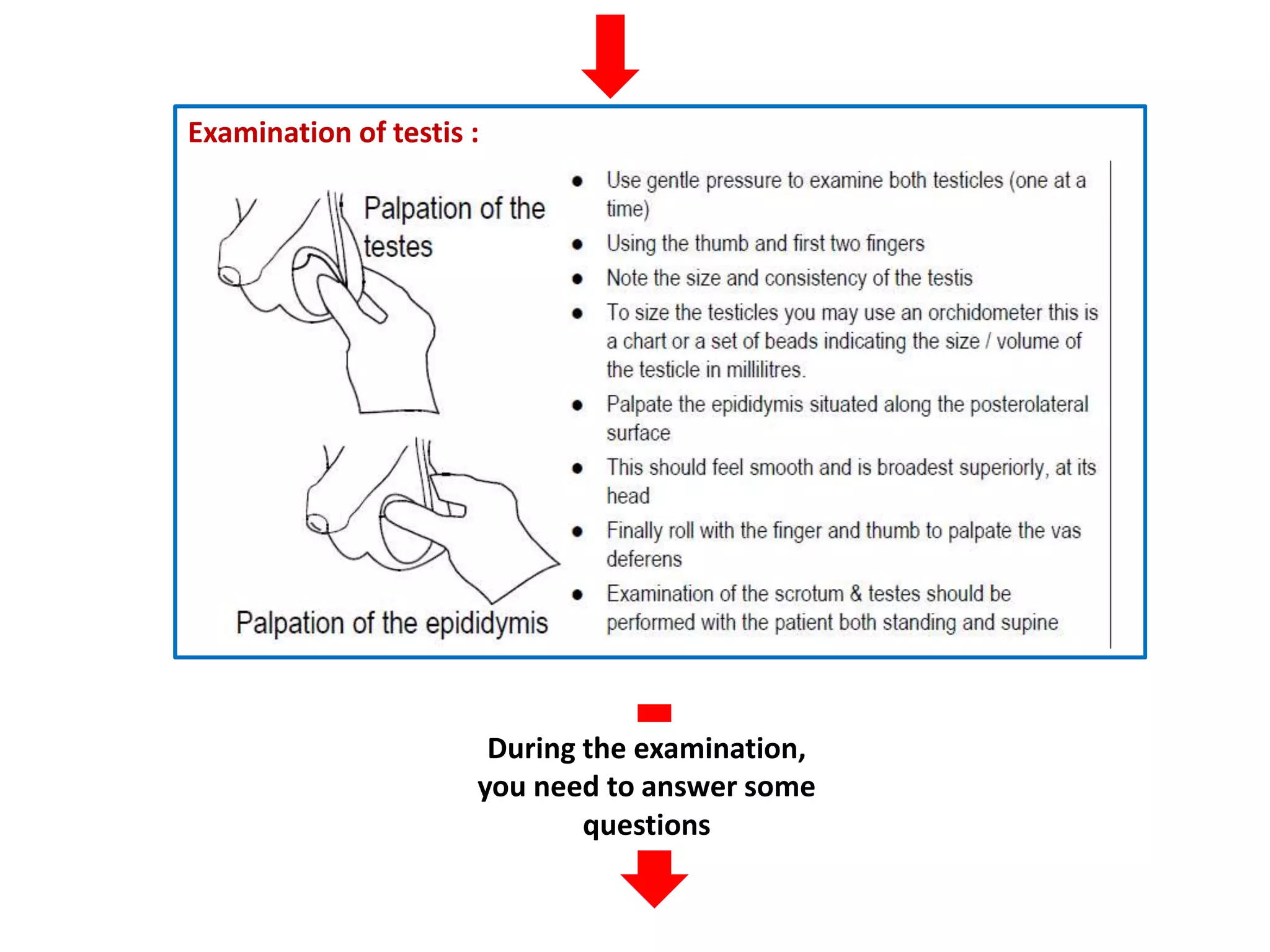 Testicular swelling | PPTX