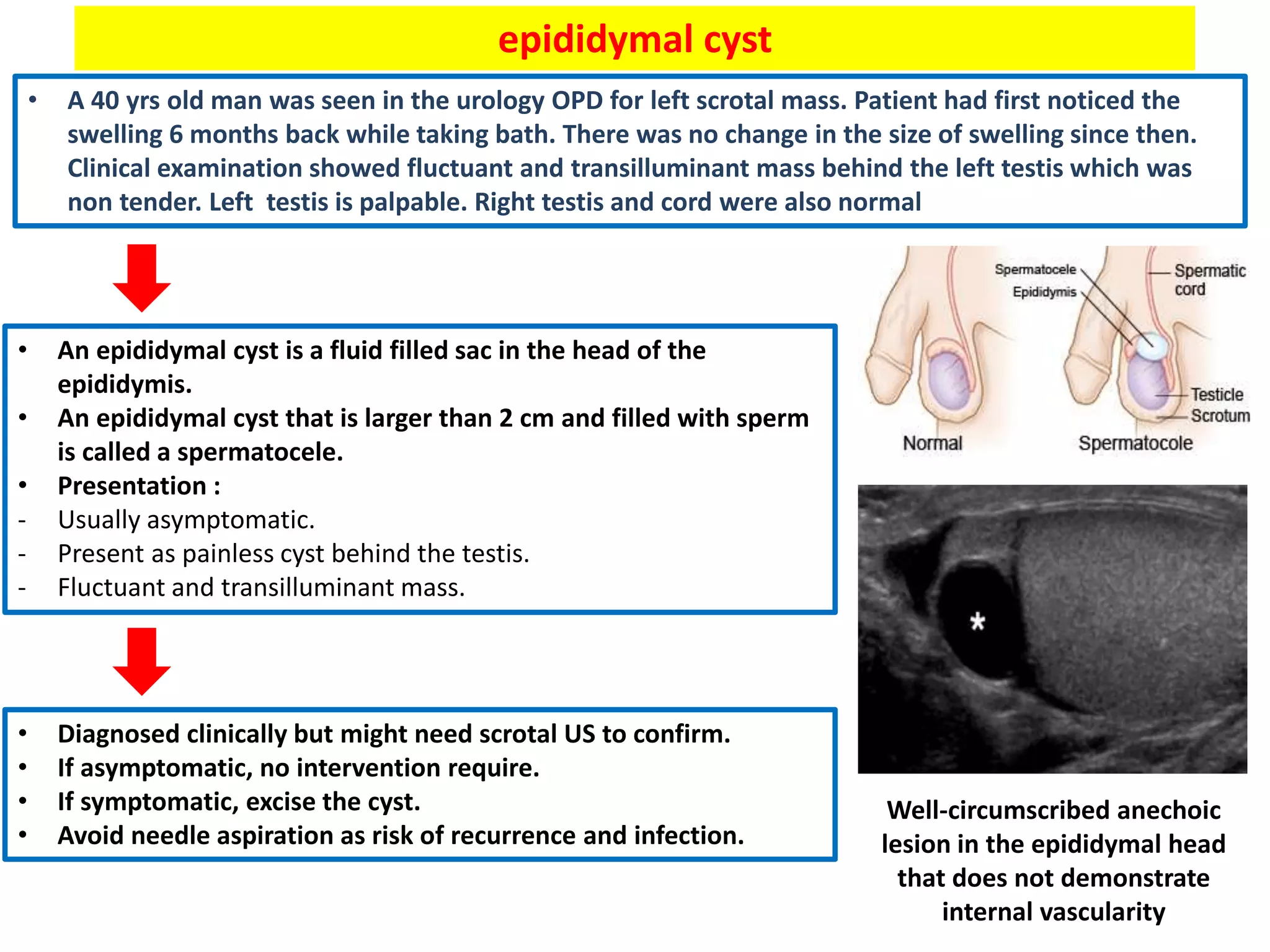 Testicular swelling | PPTX