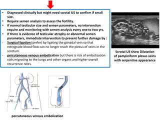Testicular swelling | PPTX