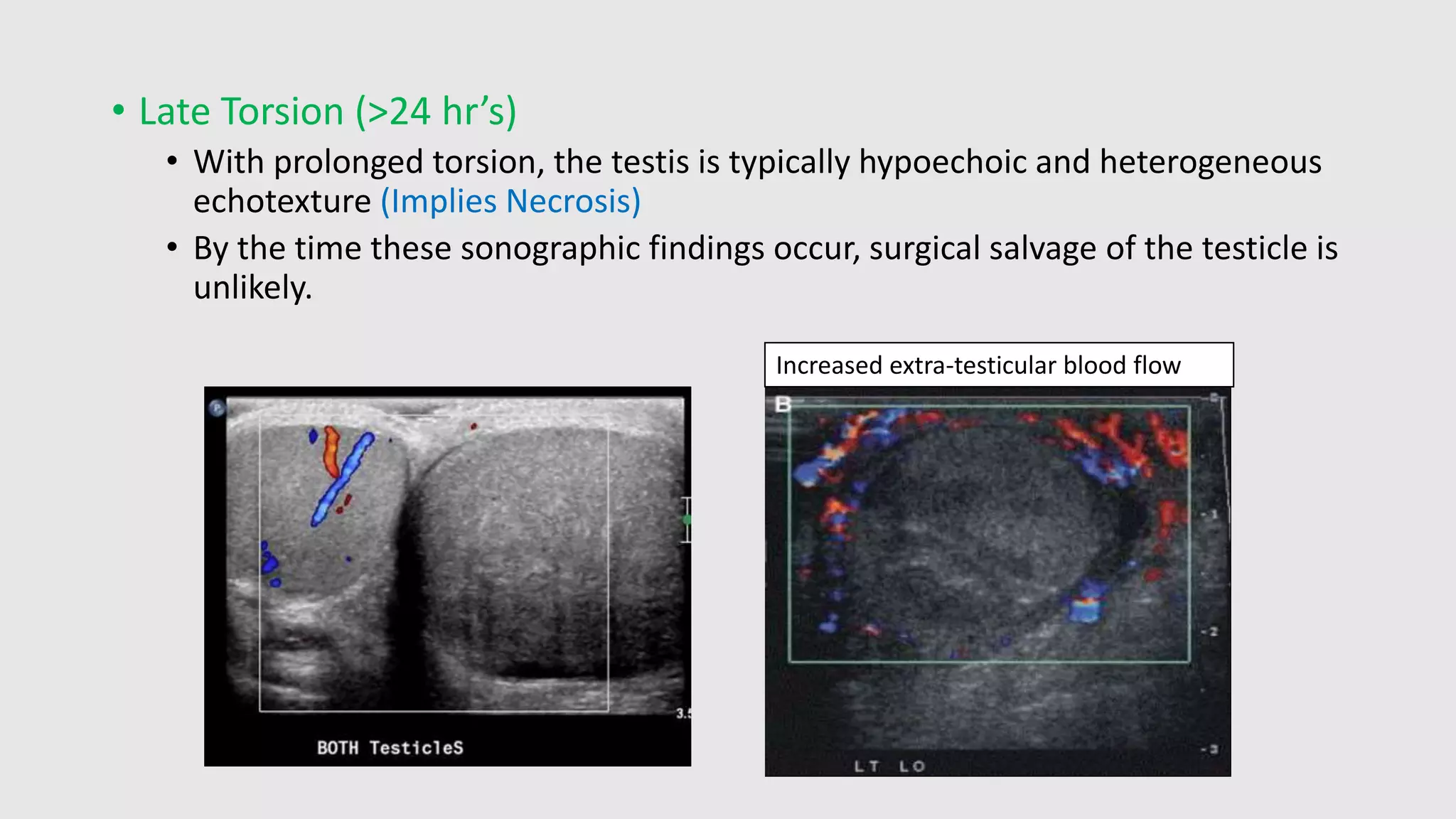 testiculartorsion-190703195435.pdf | Free Download