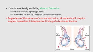 testiculartorsion-190703195435.pdf