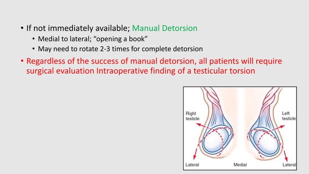testiculartorsion-190703195435.pdf