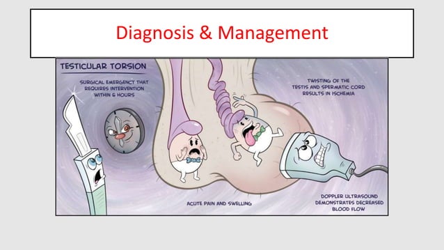Testicular Torsion - Pediatrics Surgery | PPTX