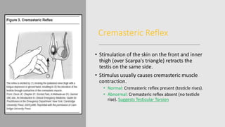 Cremasteric Reflex