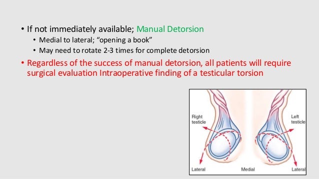 Testicular Torsion Pediatrics Surgery