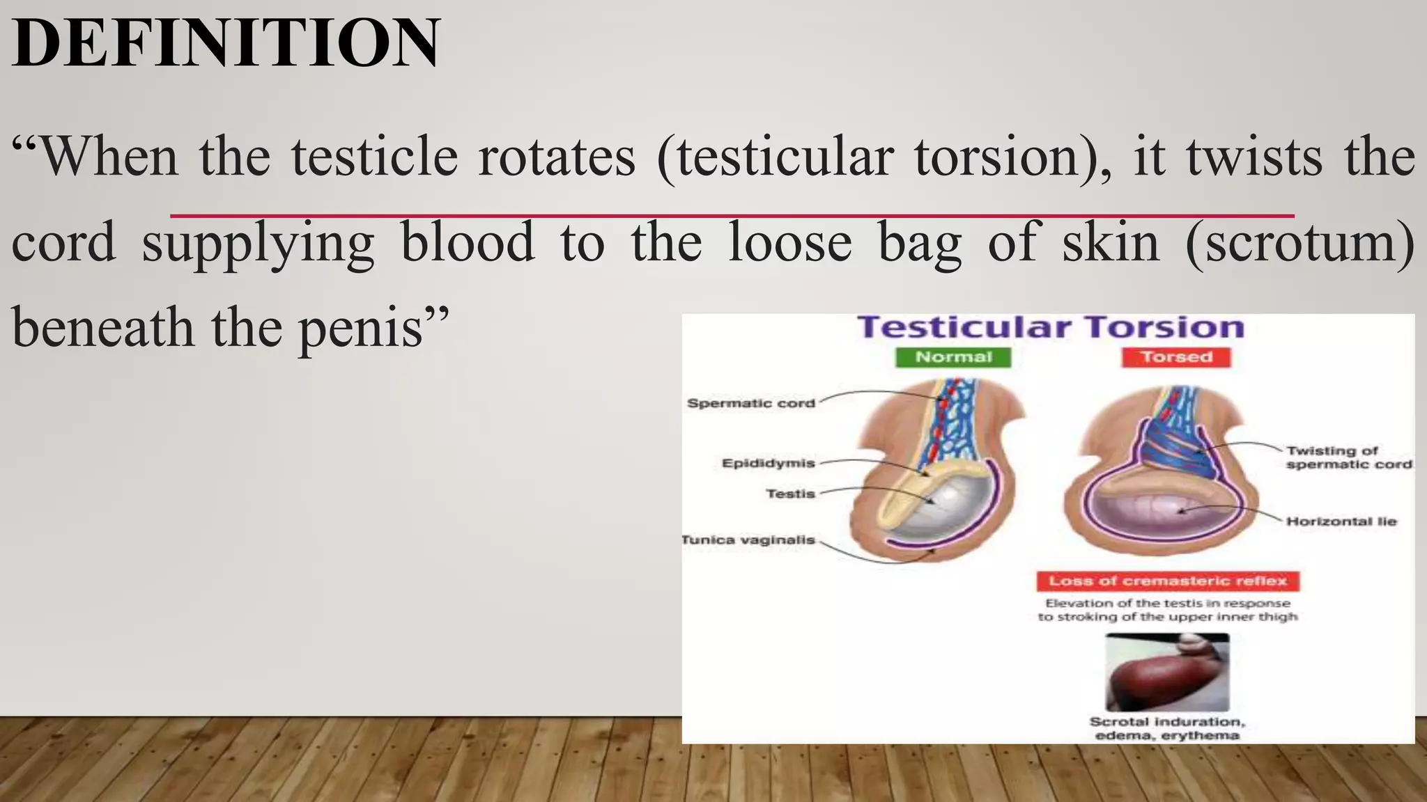 Testicular torsion.pptx