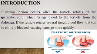 Testicular torsion.pptx