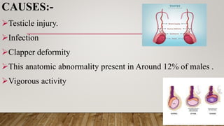 Testicular torsion.pptx