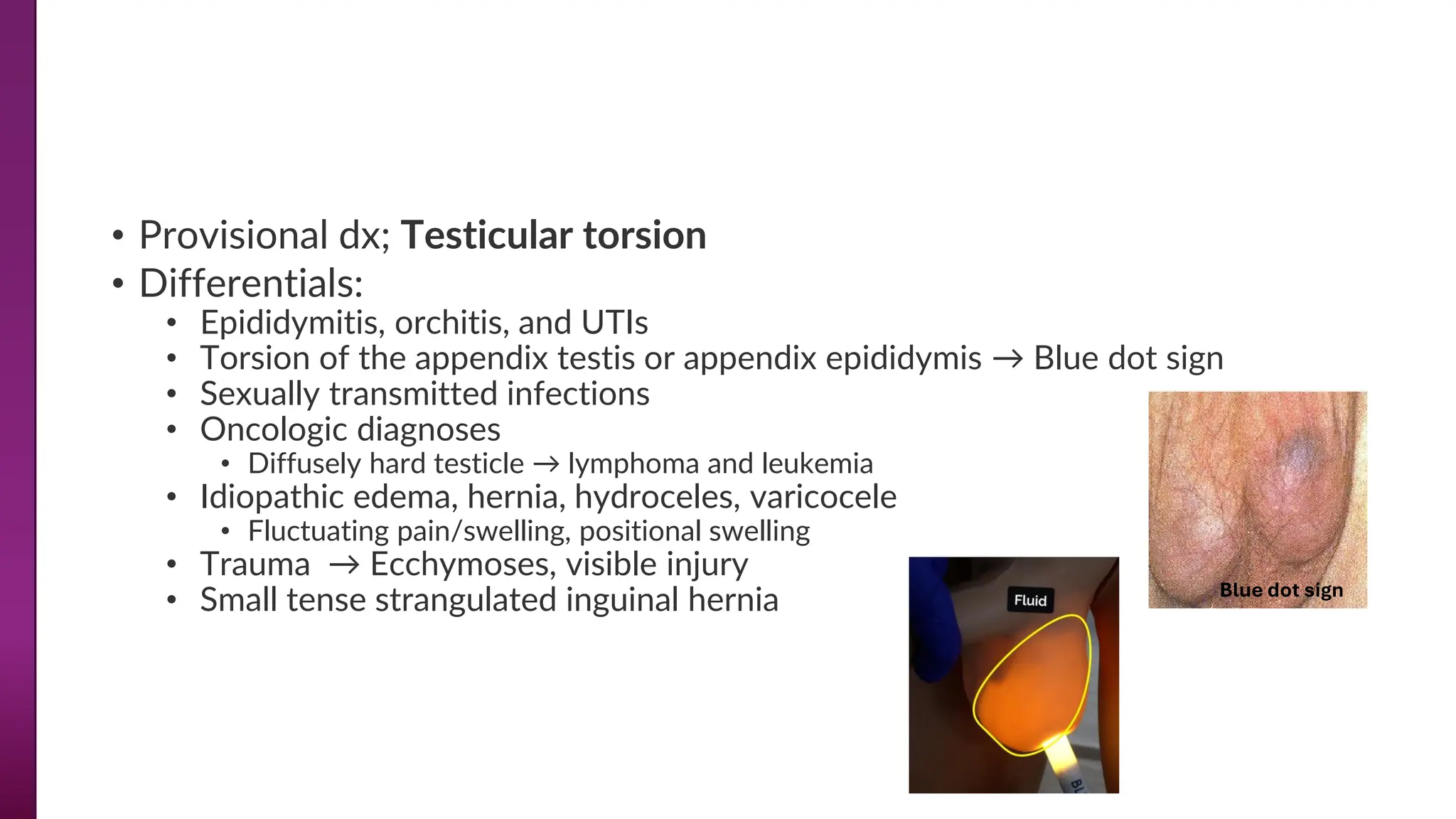 Testicular Torsion scrotal emergency.pdf