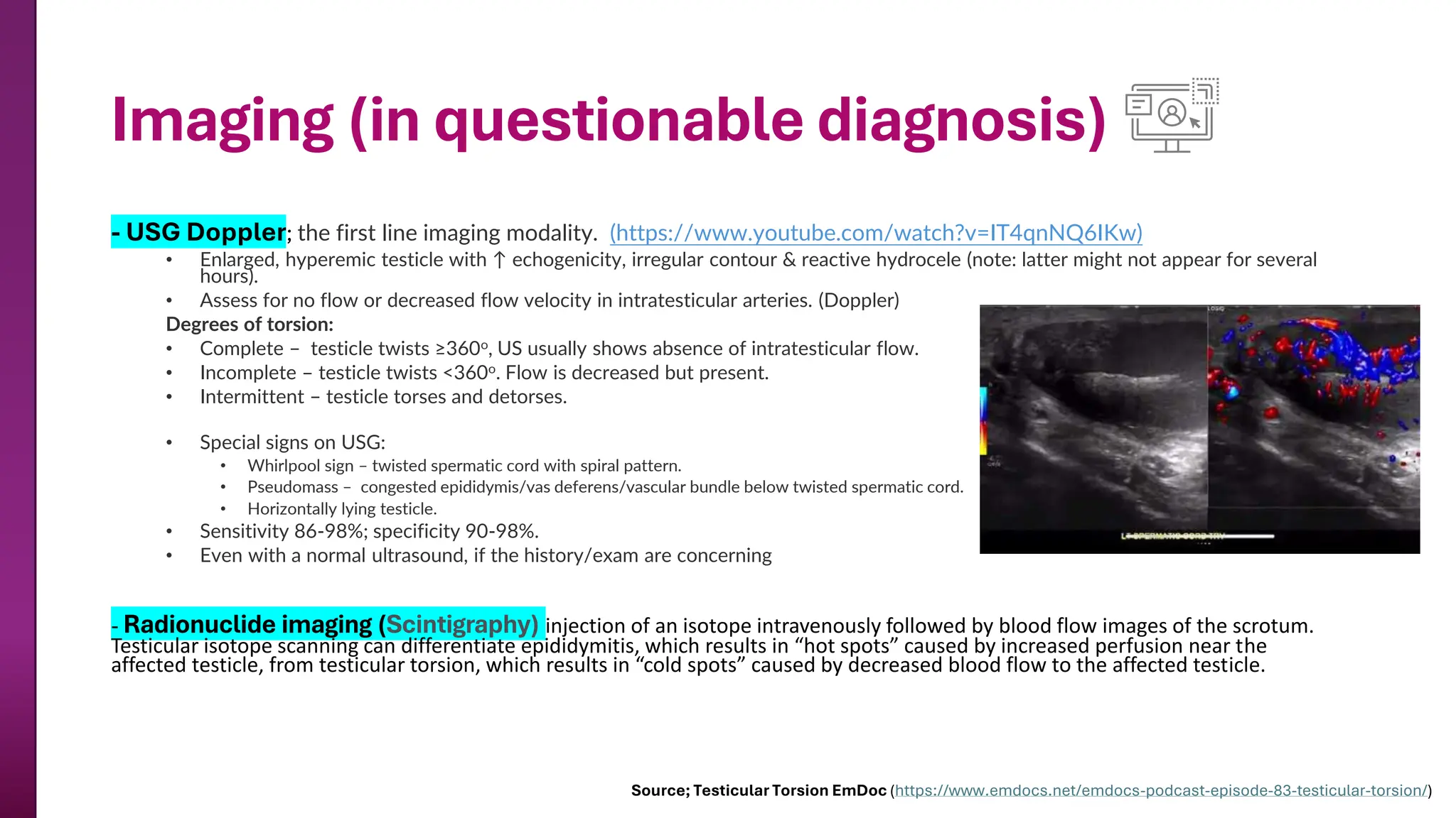 Testicular Torsion scrotal emergency.pdf