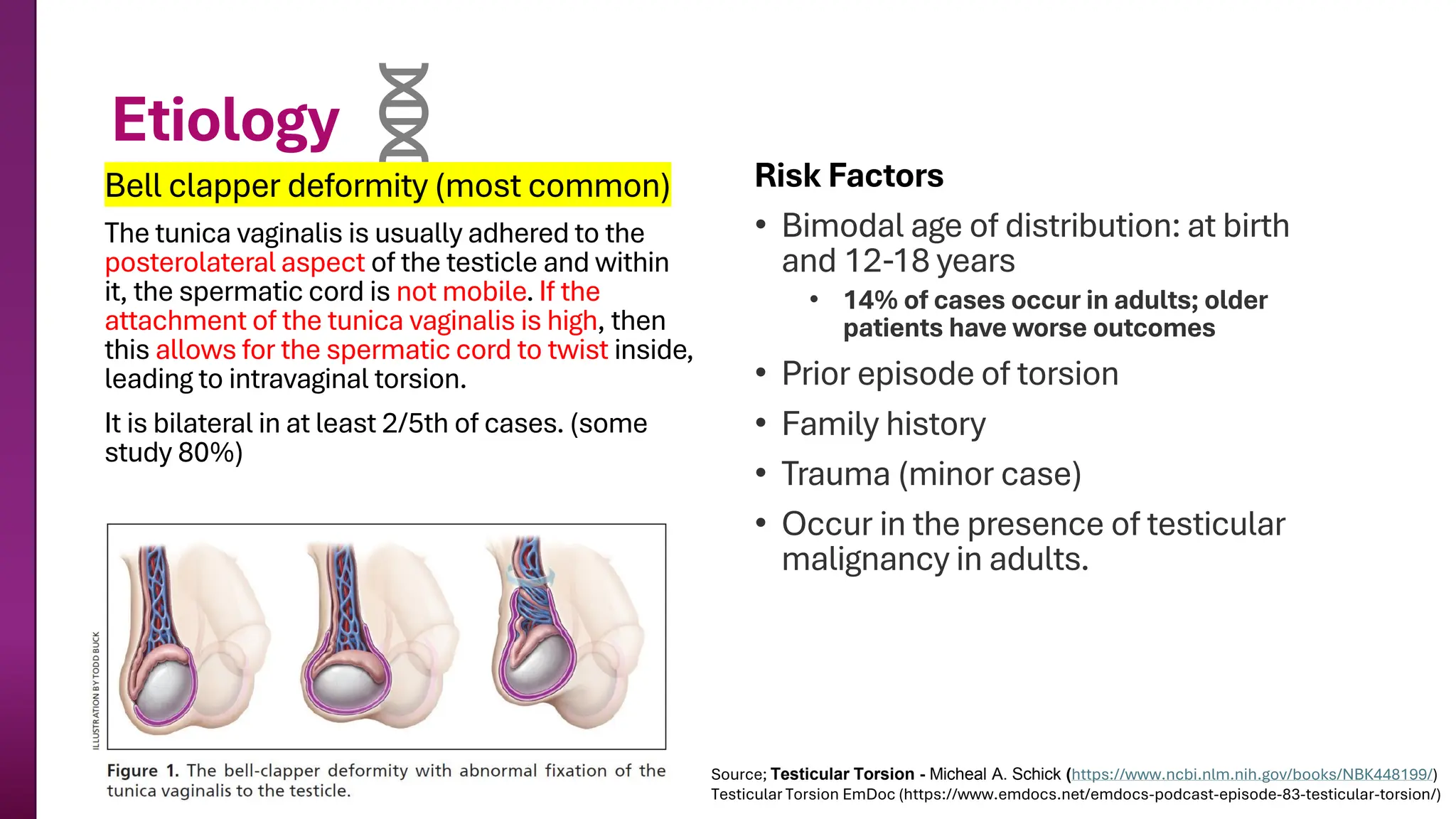 Testicular Torsion scrotal emergency.pdf