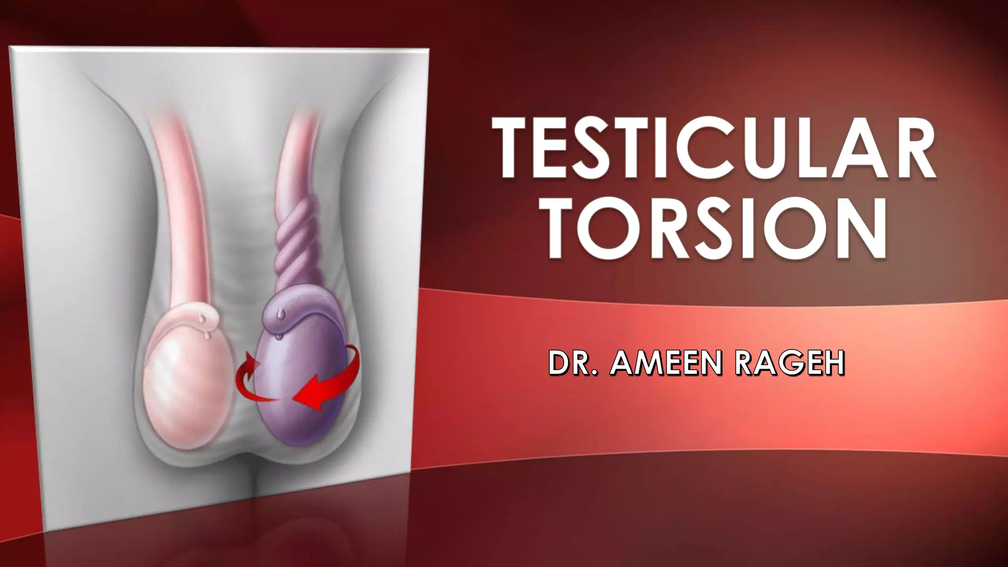 Testicular Torsion Ppt