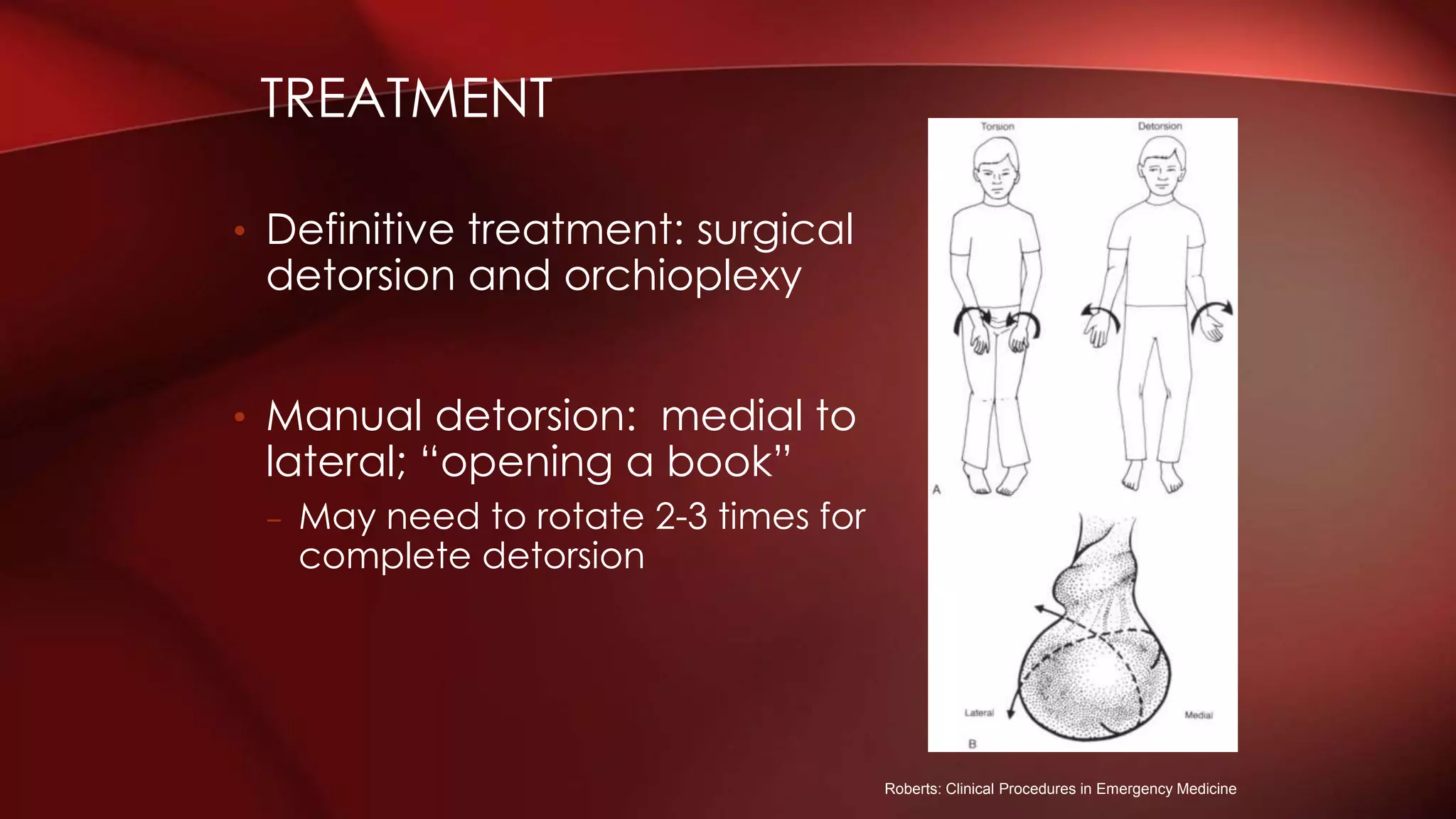 Testicular Torsion | PPTX