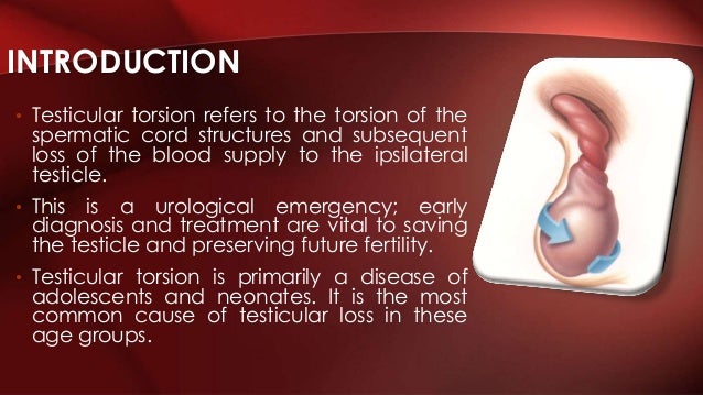 Testicular Torsion
