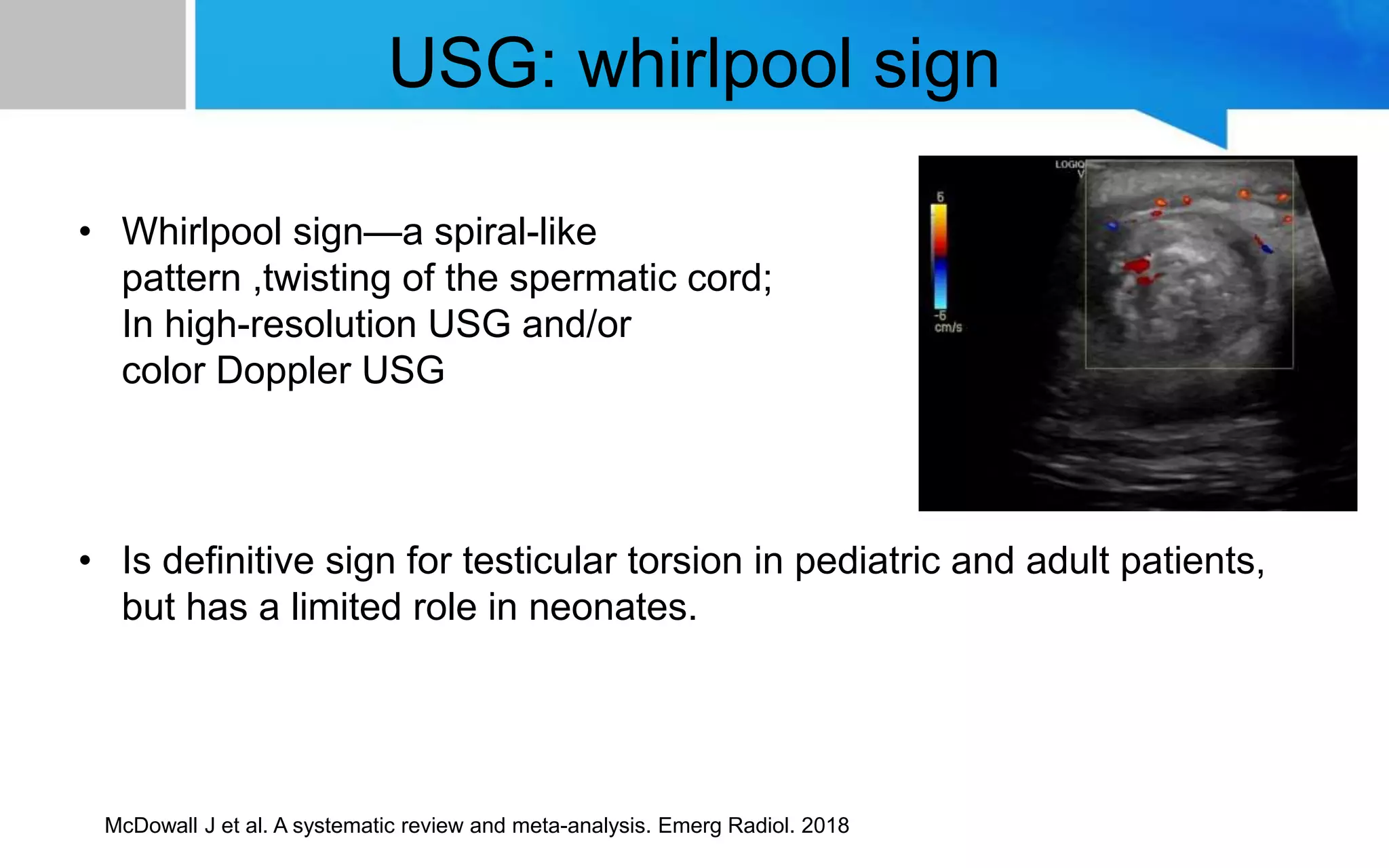 Testicular torsion/ Torsion of testes | PPT