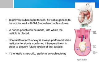 Testicular torsion/ Torsion of testes | PPT