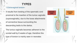 Testicular torsion and Epididymo-orchitis.pptx