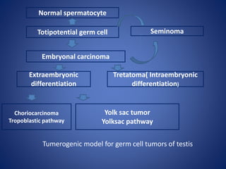 Testicular tumor | PPTX