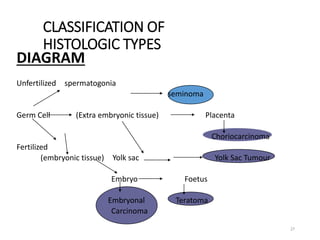 Management of Testicular Tumors | PPT