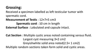 testicular tumor case presentation.pptx