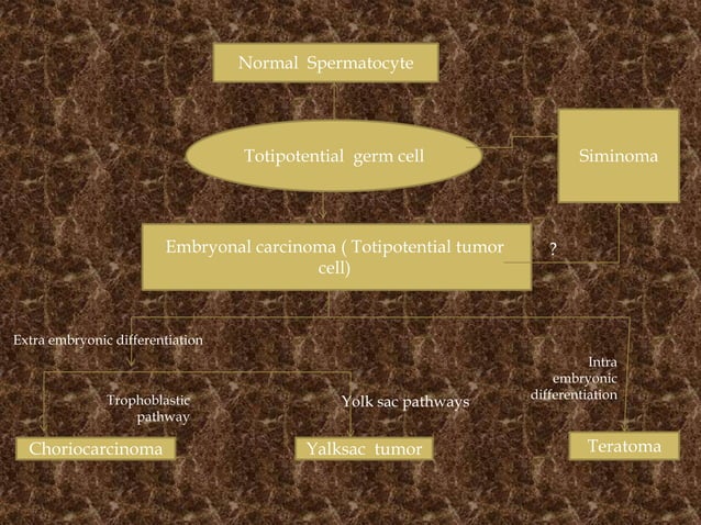Testicular tumor | PPTX | Reproductive Health | Diseases and Conditions