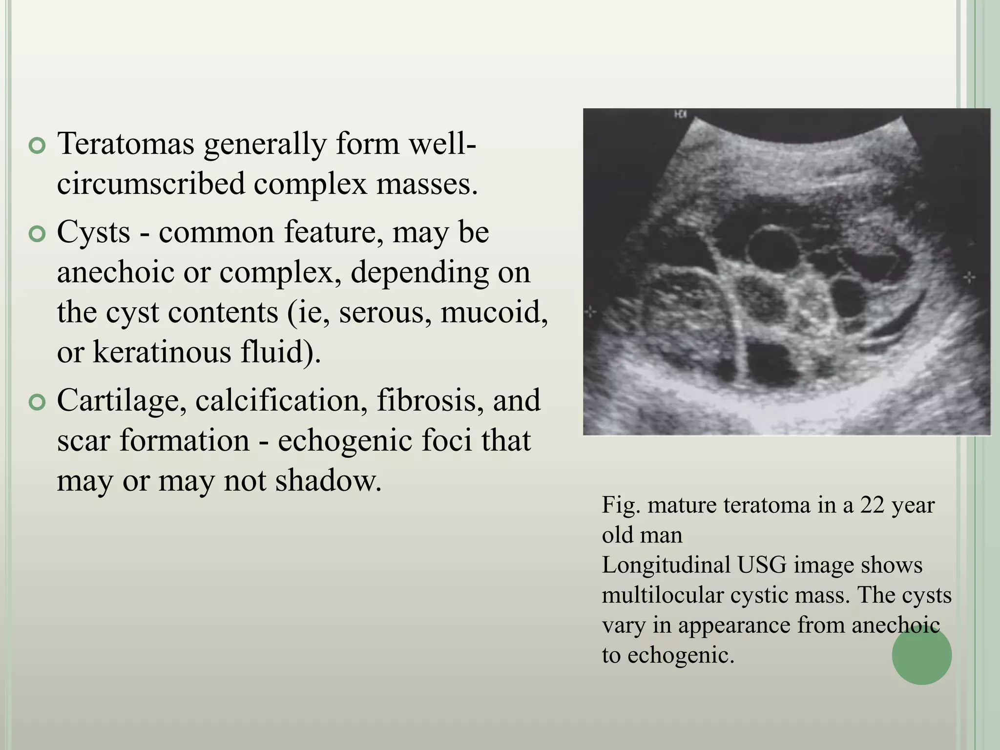 Testicular tumor imaging | PPTX