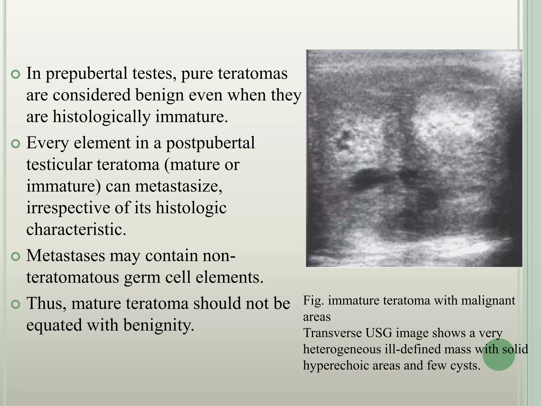Testicular tumor imaging | PPTX
