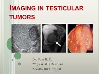 Testicular Cancer Pictures Medical Image Search