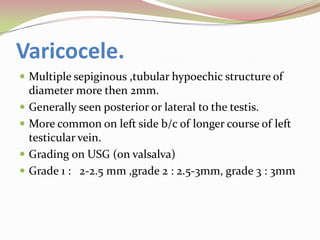 Testicular tumors | PPTX