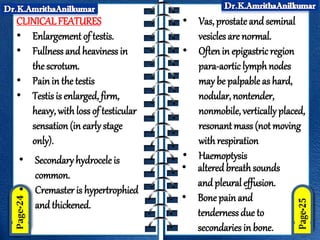 Testicular tumors | PPTX
