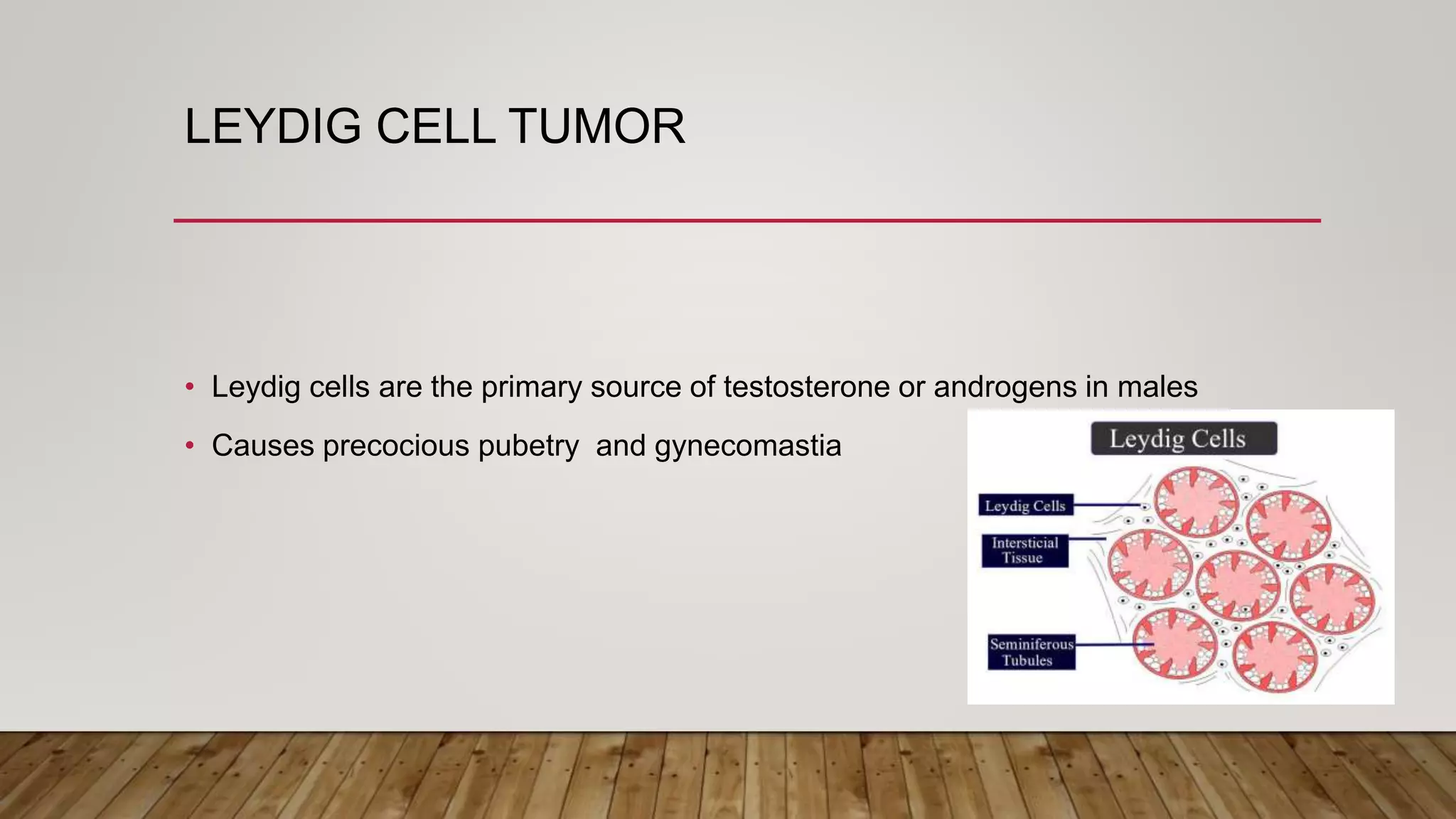 Testicular Tumors.pptx