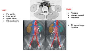 management of TESTICULAR TUMORS | PPT