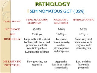Testicular tumors | PPT