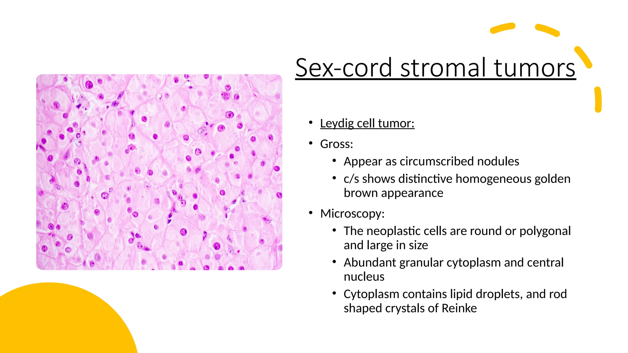 Testicular tumors pathology with histology | PPTX