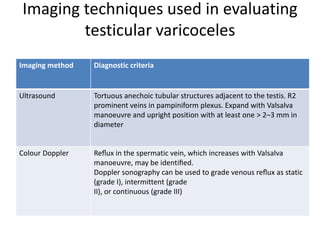 Varicocele Ultrasound Criteria