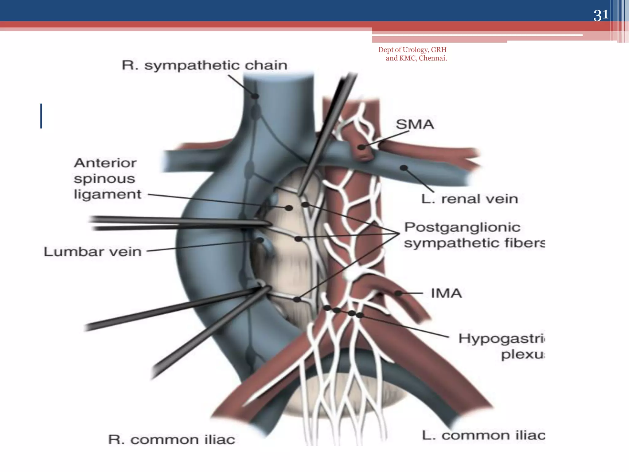 Testis carcinoma- management- lymphatic drainage and rplnd | PDF
