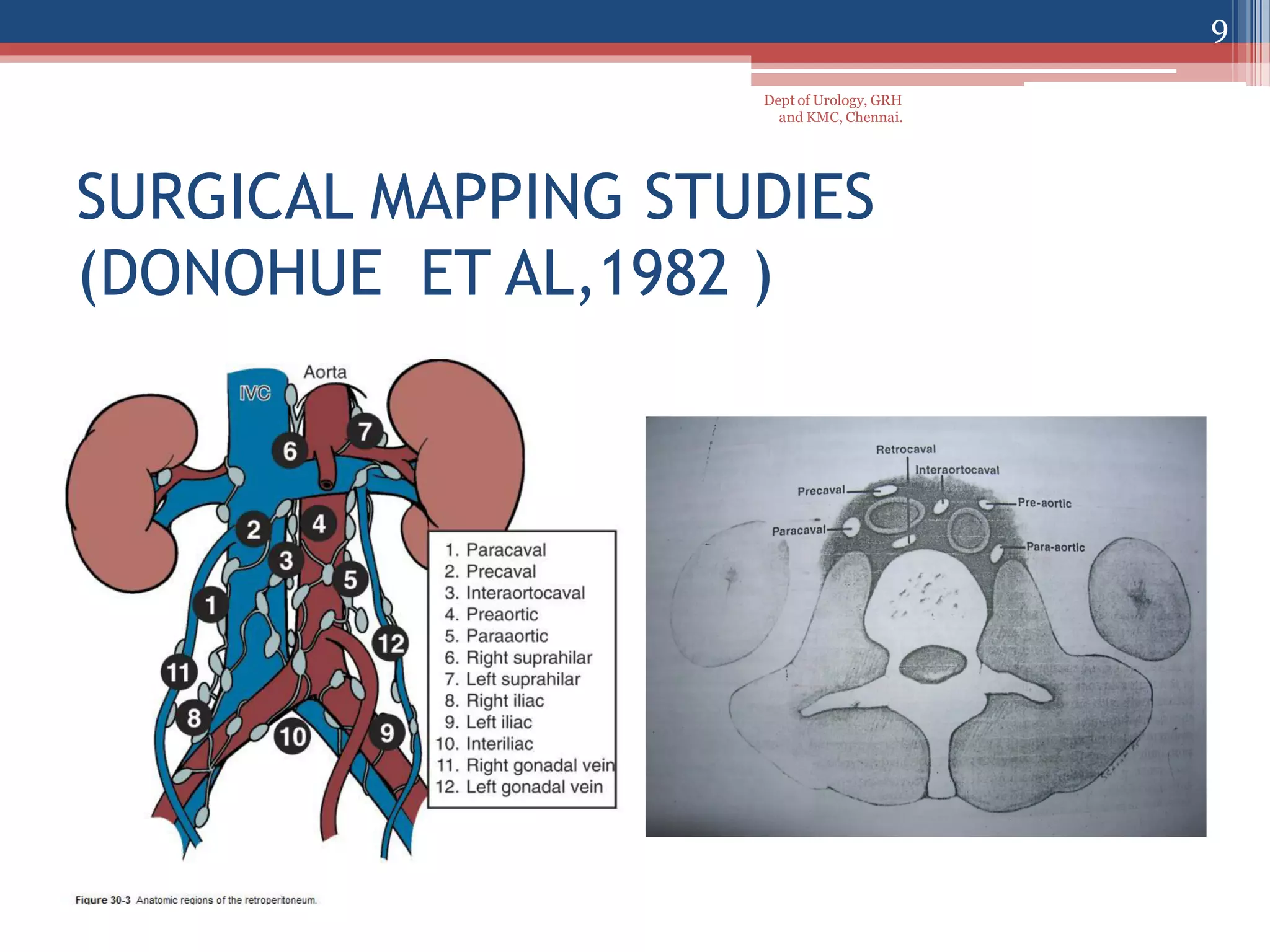 Testis carcinoma- management- lymphatic drainage and rplnd | PDF