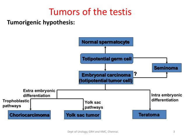 Testis carcinoma- management- nsgct | PPT