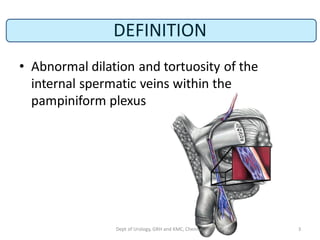 Testis varicocele | PDF