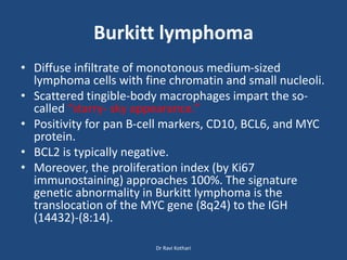 Testis lymphoma RA 25-1.pptx