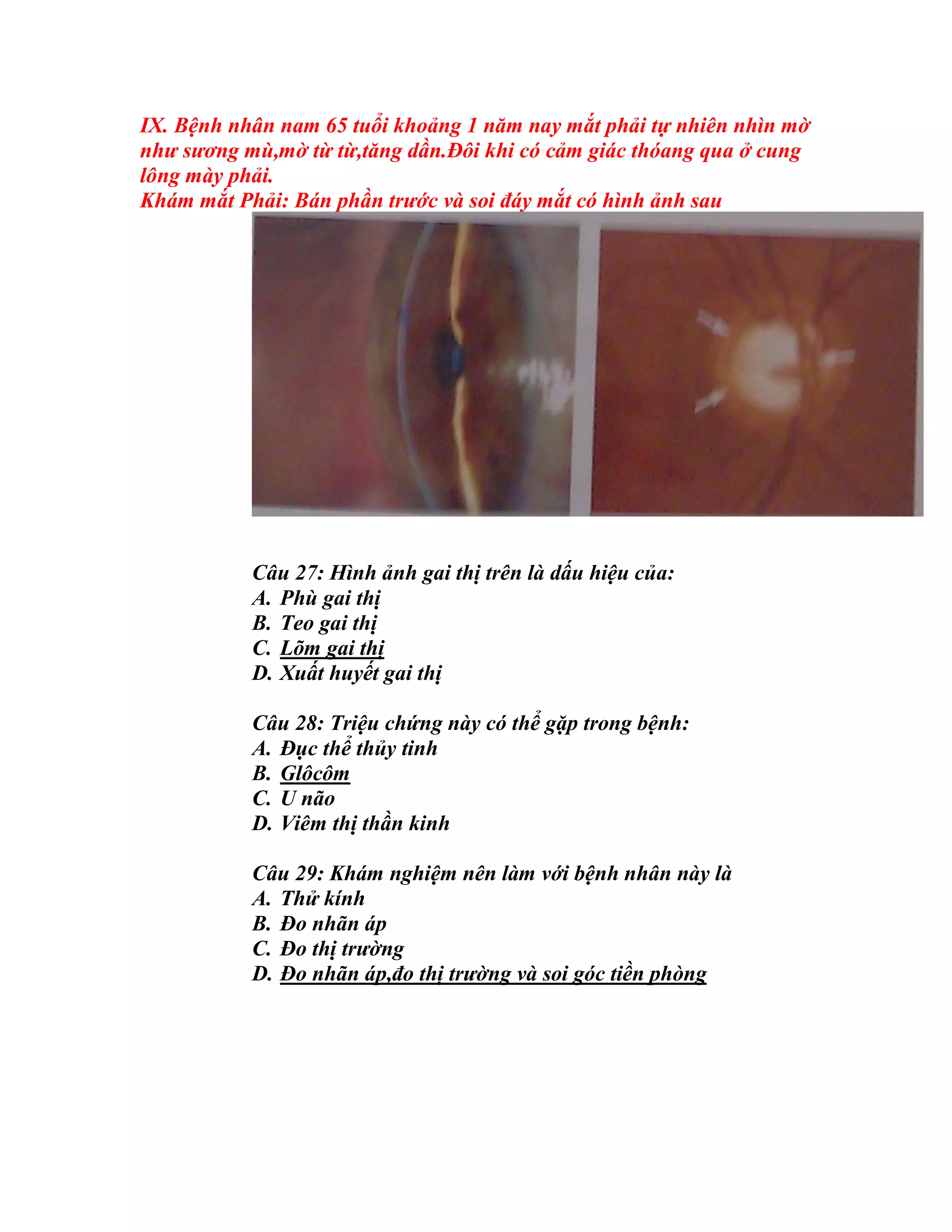 Test mat | PDF