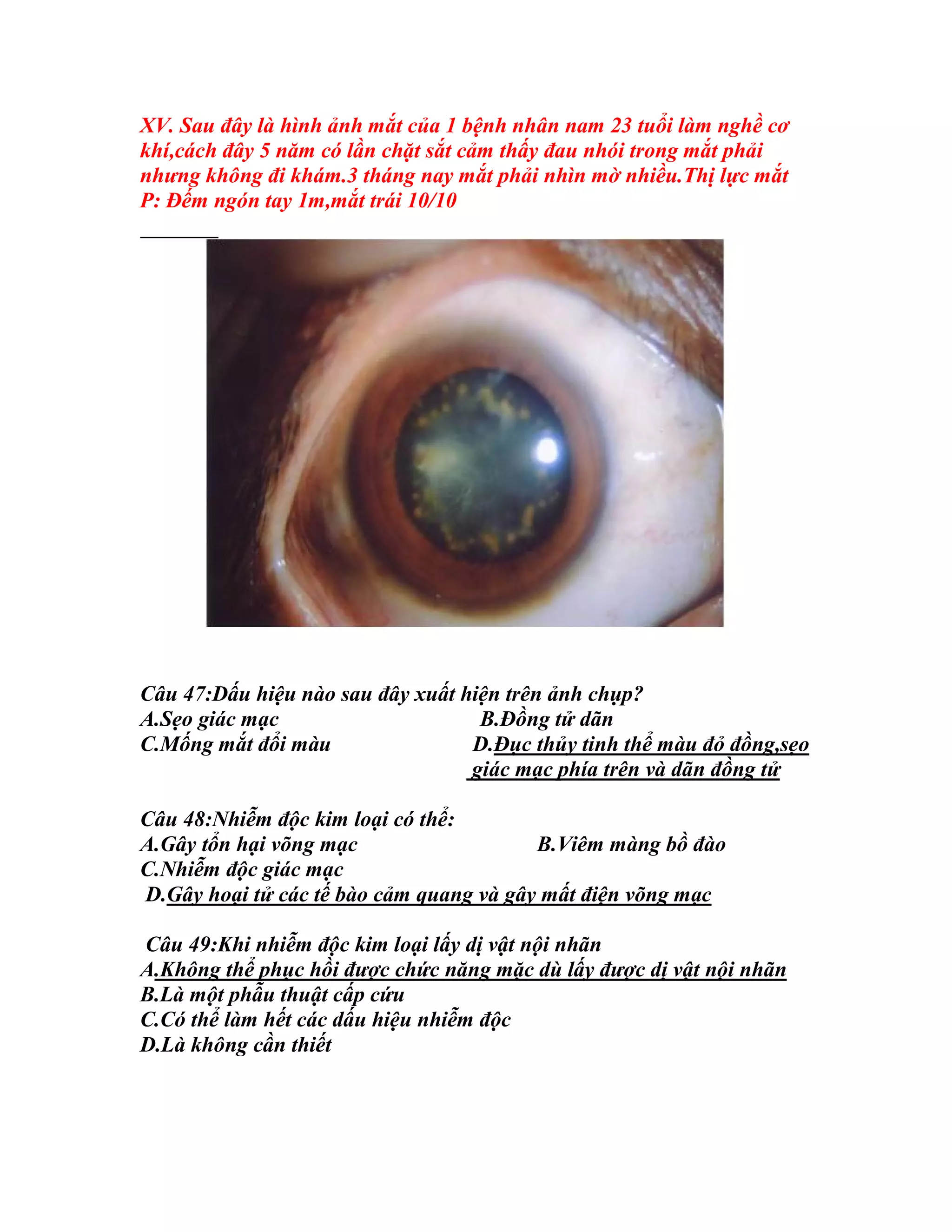 Test mat | PDF