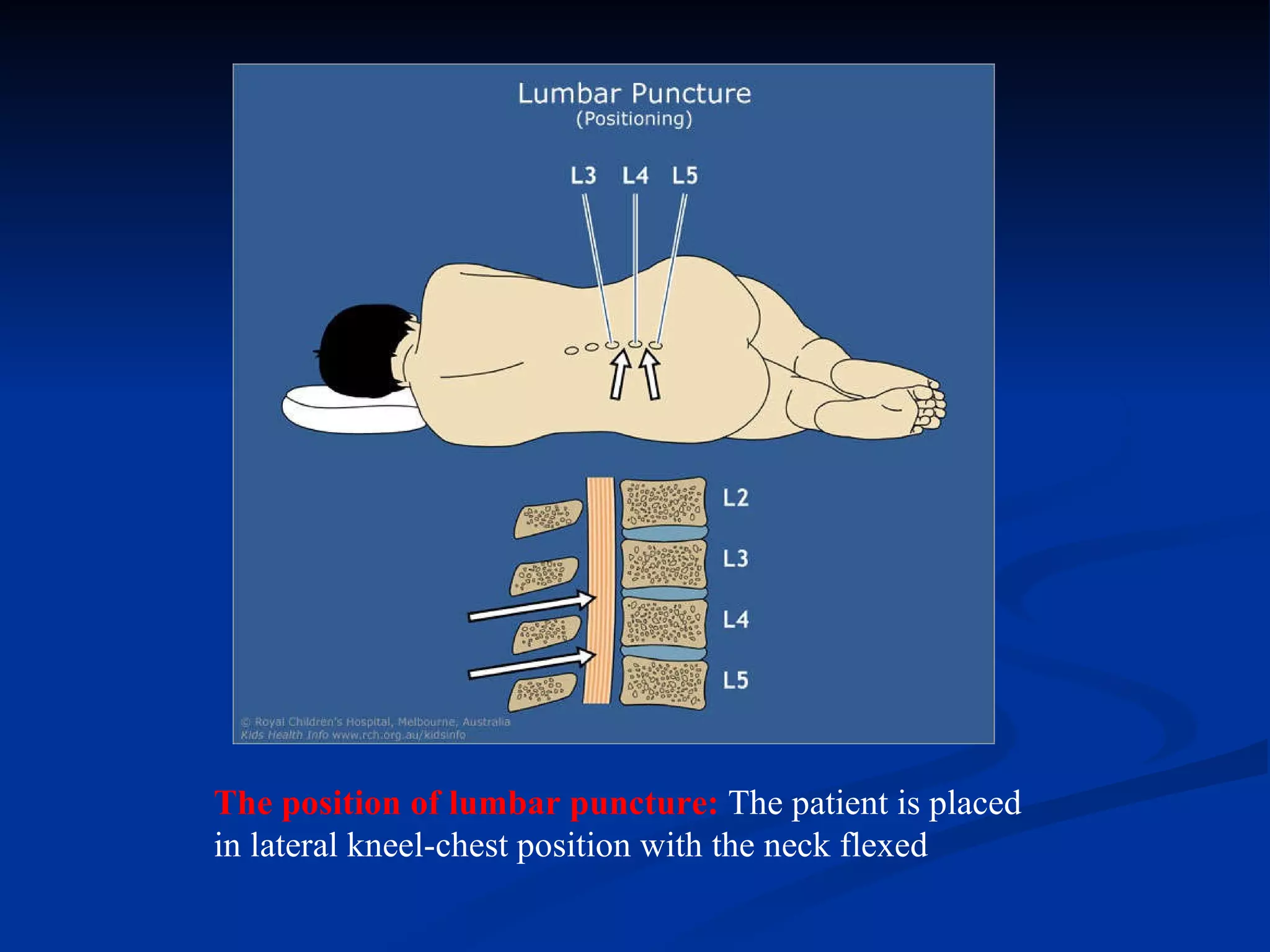 Test Of Cerebrospinal Fluid And Serous Membrance Effusion | PPT | Free ...