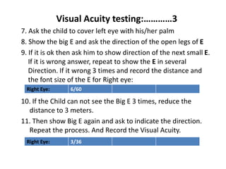 Test of distance vision, near vision visual field bs ed | PPTX