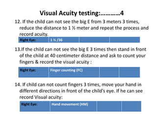 Test of distance vision, near vision visual field nusrat zerin ...