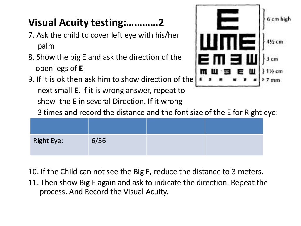 Test Of Distance Vision Near Vision Visual Field Nusrat Zerin Assis test-of-distance-vision-near-vision-visual-field-nusrat-zerin-assis
