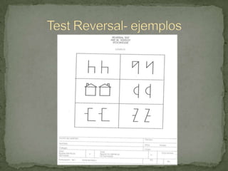 Test reversal | PPTX