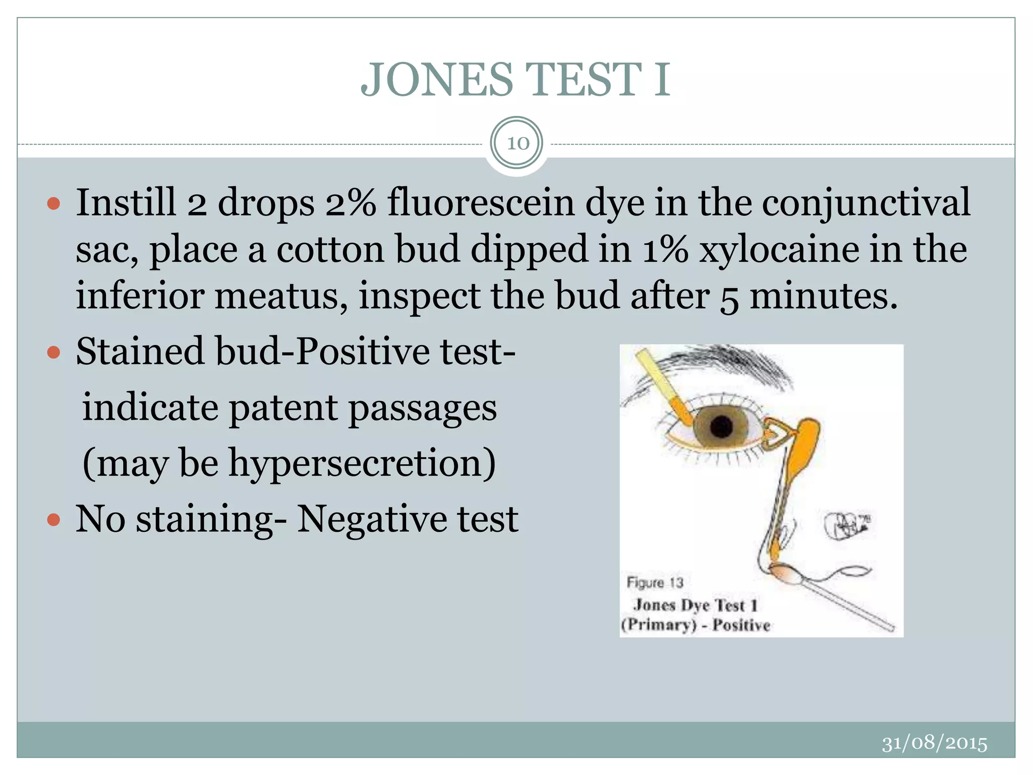 Tests done to assess patency of lacrimal drainage | PPTX