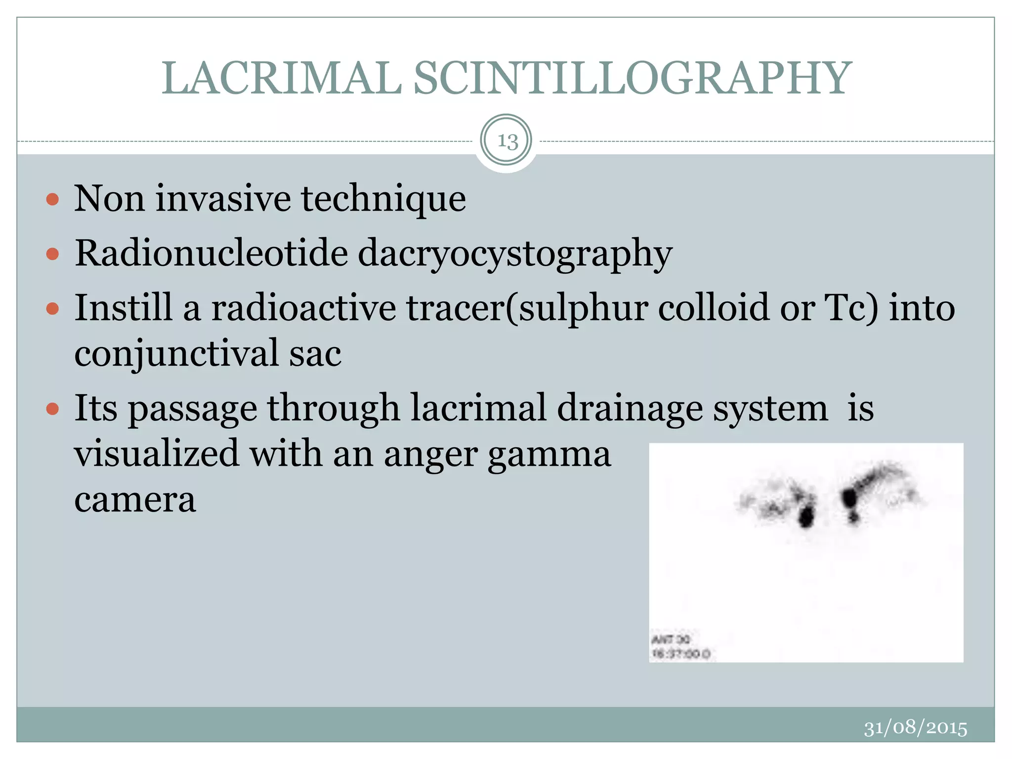 Tests done to assess patency of lacrimal drainage | PPTX